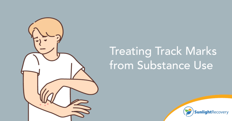 Treating Track Marks from Substance Use - Sunlight Recovery | Boca ...